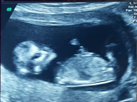 Seeing and Helping Experimental Hybrid Children | Galactic Anthropology